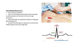 Coronary CT Angiography .dr aya.pdf