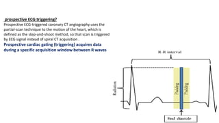 Coronary CT Angiography .dr aya.pdf