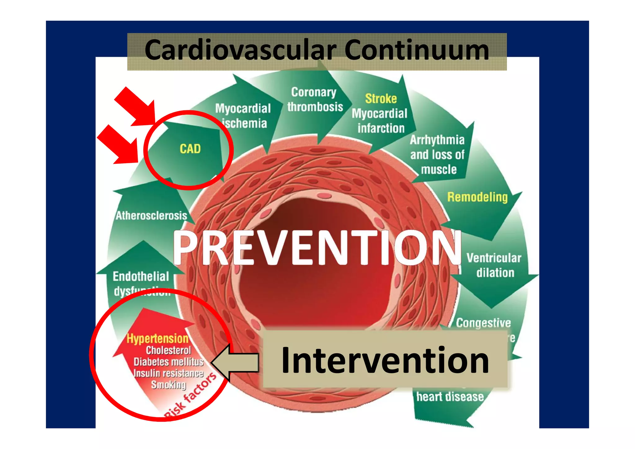 Global Burden of Coronary Heart Disease | PDF