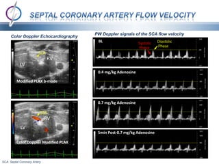 Coronary Flow Via Echocardiography | PPT