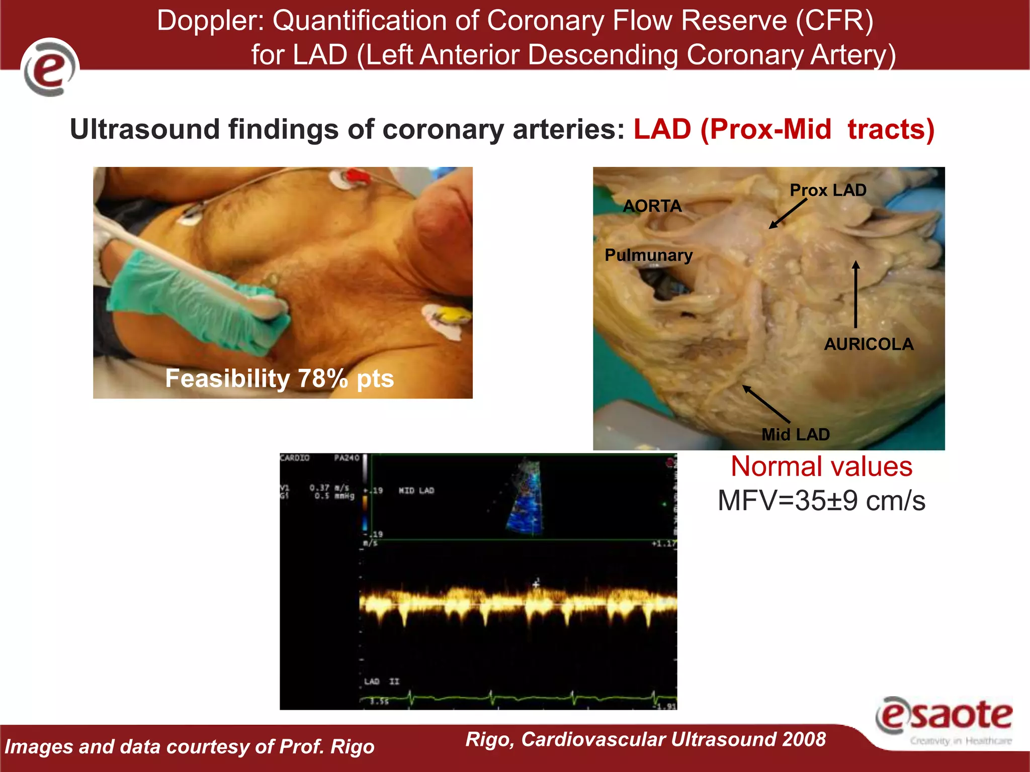 Coronary flow imaging | PPTX