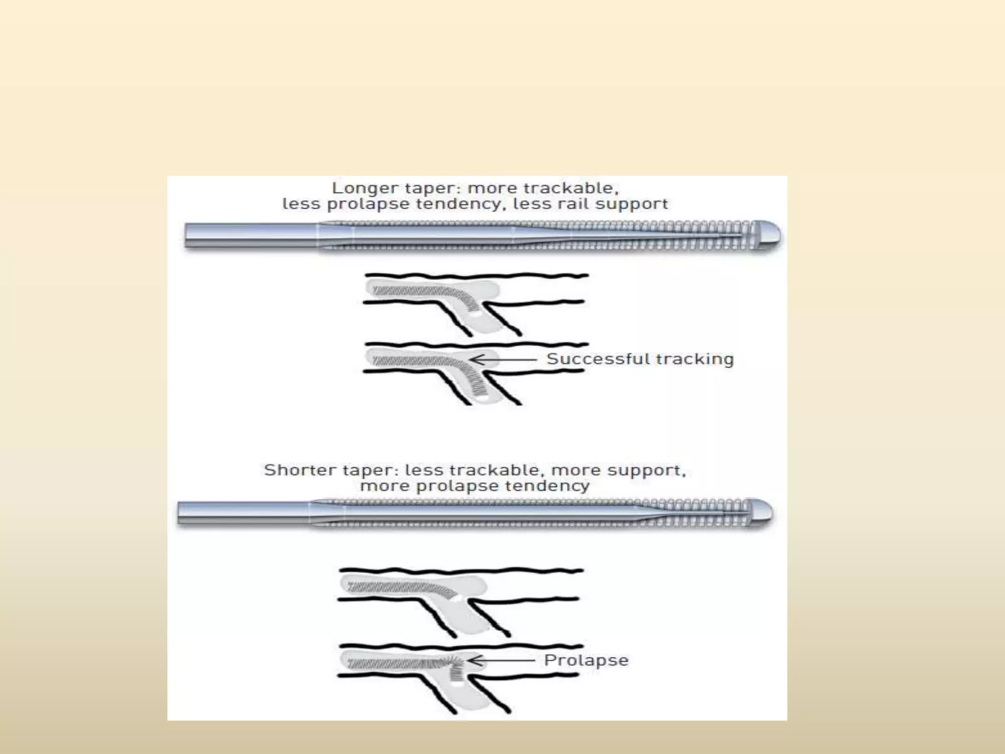 Coronary guidewires | PPTX