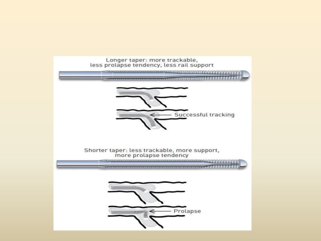 Coronary guidewires | PPTX
