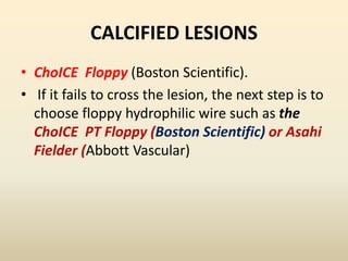 Coronary guide wires | PPTX