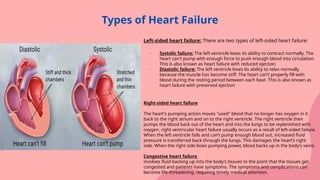 Coronary Heart Disease presentation .pptx