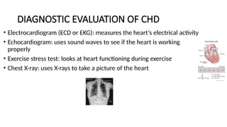 CORONARY HEART DISEASE. PowerPoint Presentation | PPTX
