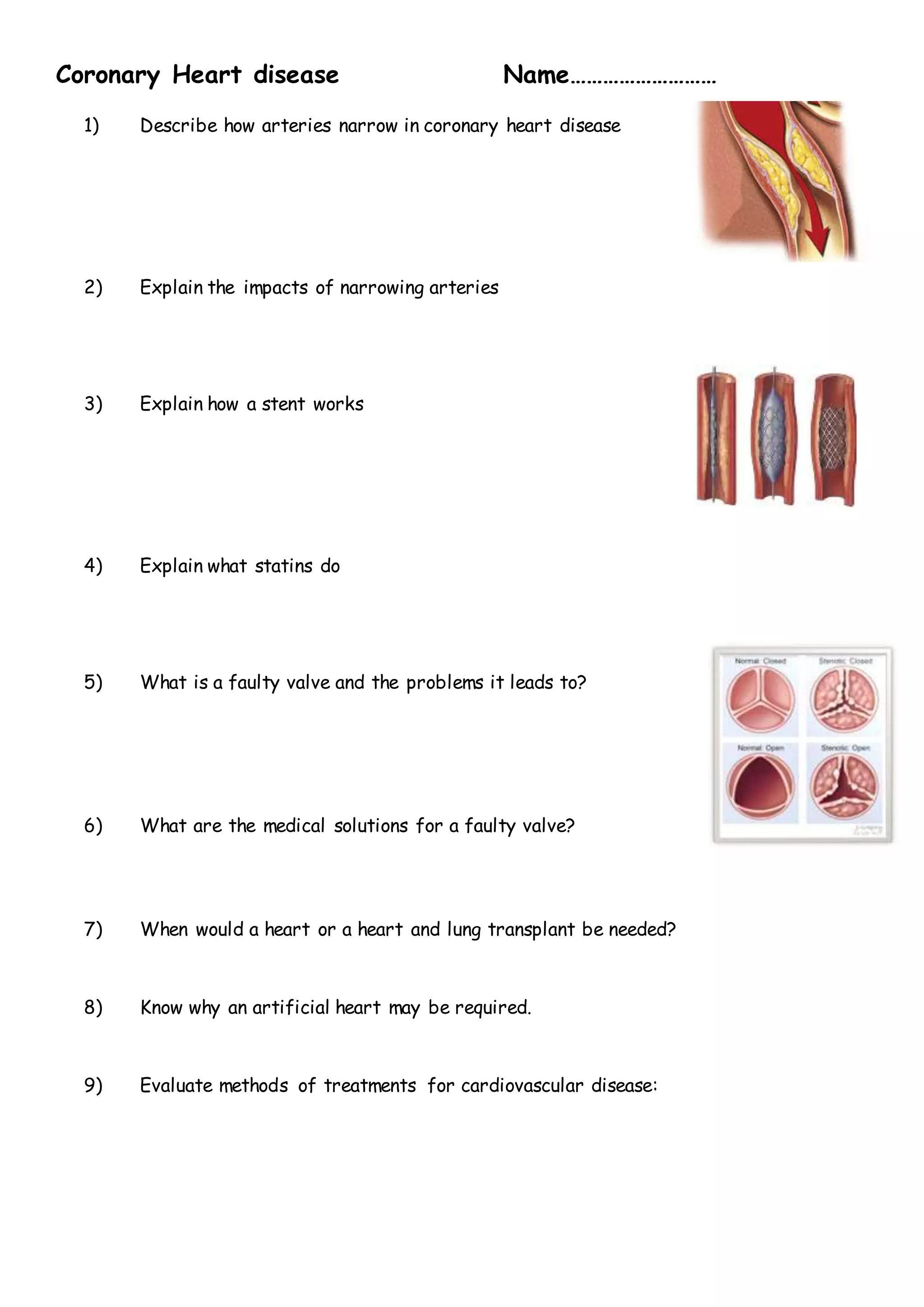 Coronary heart disease qs | DOCX
