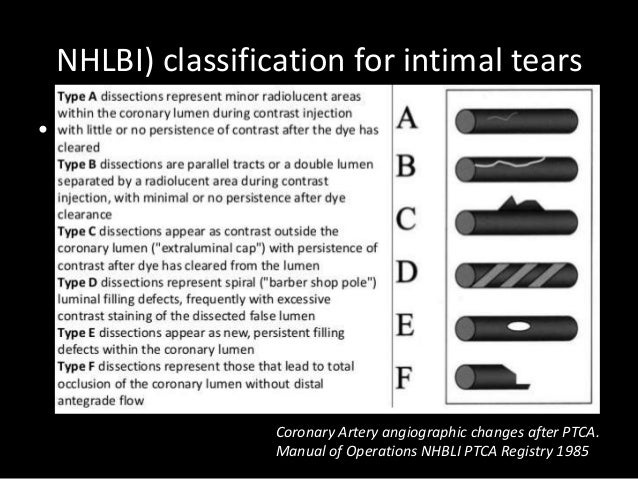 Coronary Intramural Hematoma