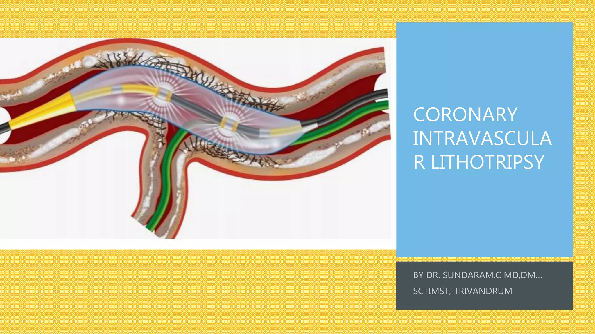 Coronary Intravascular Lithotripsy | PPTX
