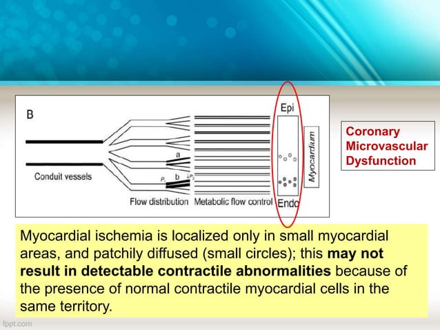 Coronary Microvascular Disease Management.ppt