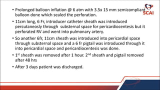 coronary perforation.pptx | Heart and Cardiovascular Diseases ...