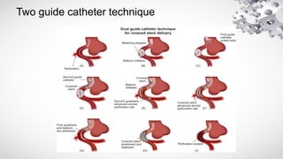 CORONARY PERFORATION - PCI COMPLICATIONS 1.pptx