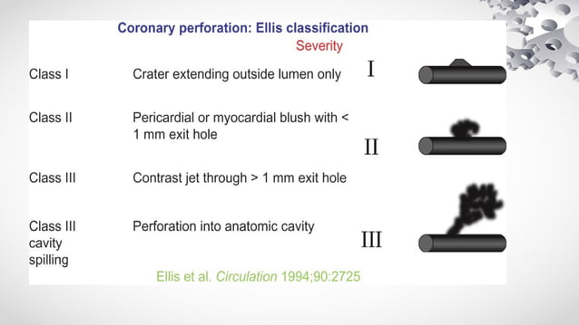 CORONARY PERFORATION - PCI COMPLICATIONS 1.pptx
