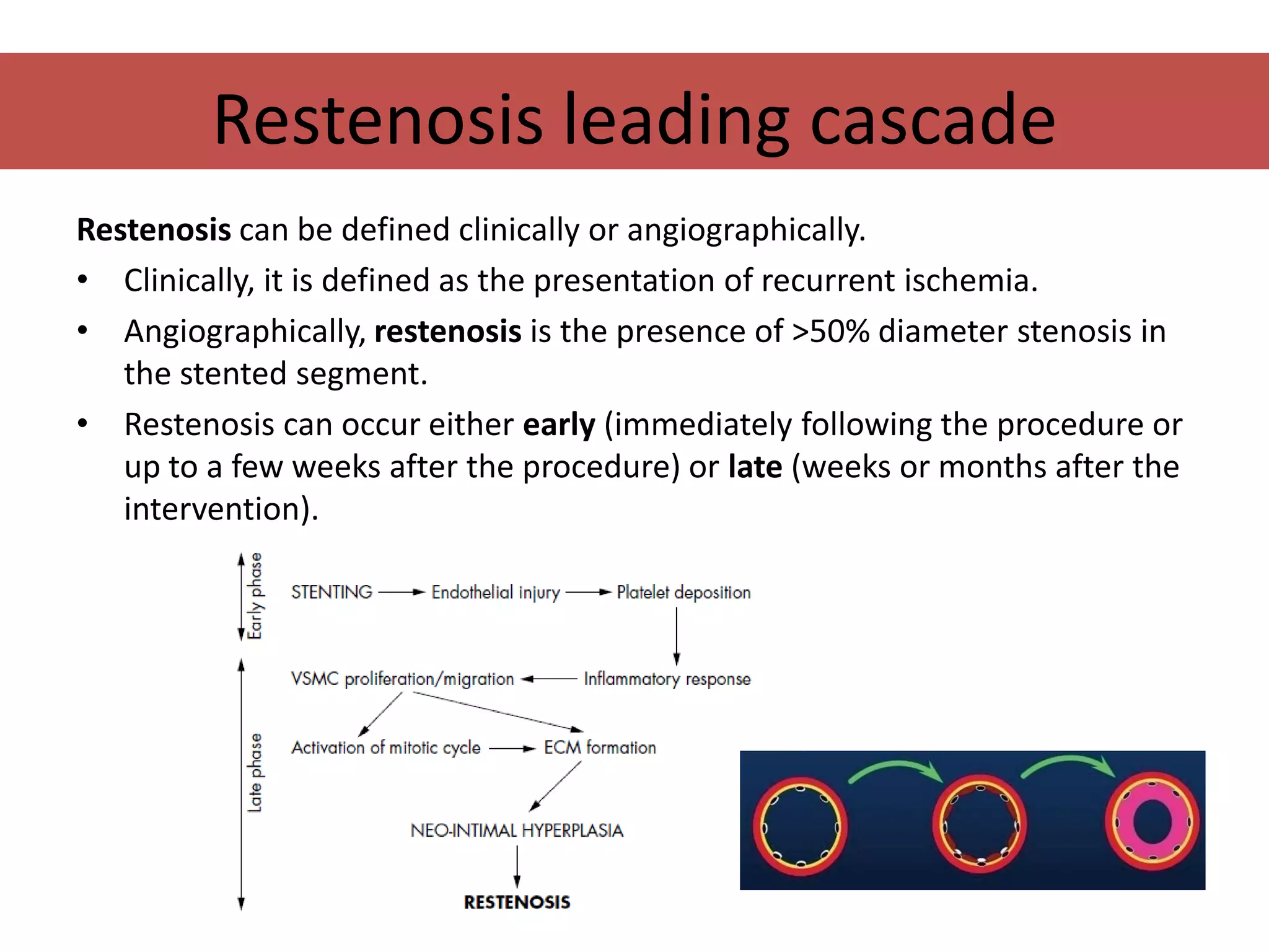 Coronary restenosis after stent implantation | PDF