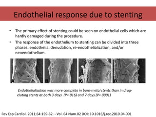 Coronary restenosis after stent implantation | PDF