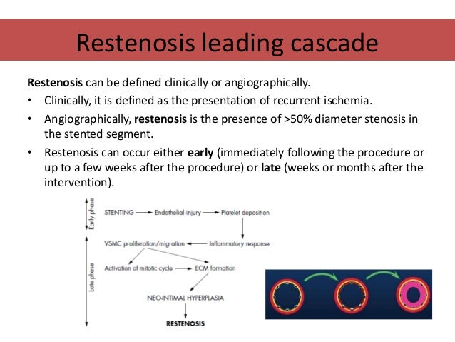 Coronary restenosis after stent implantation