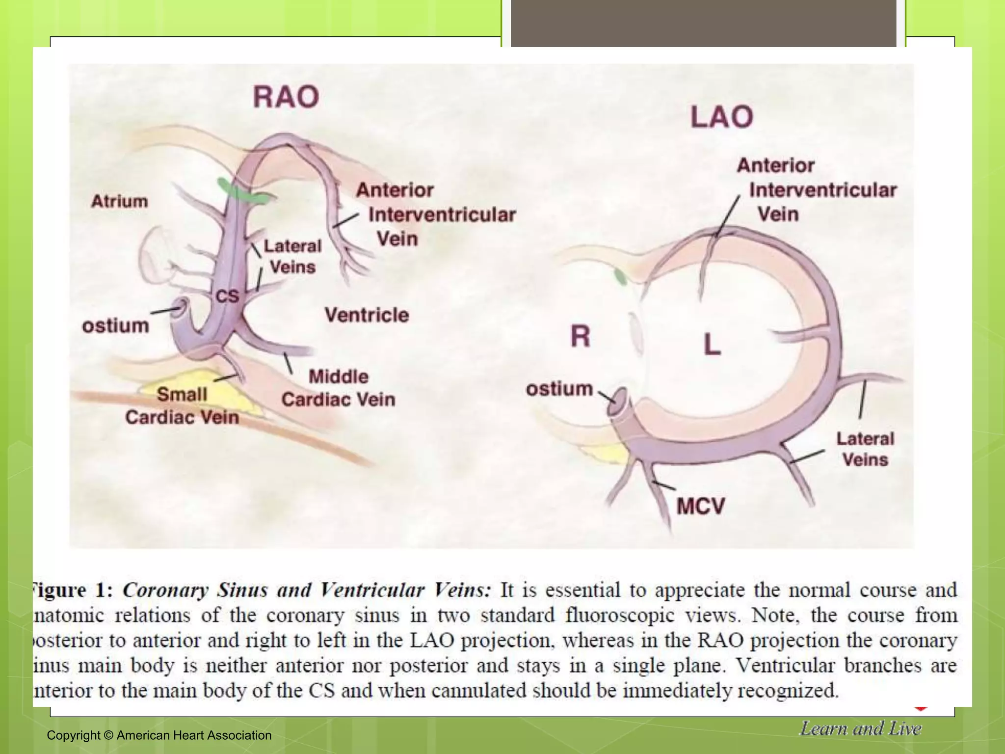 coronary sinus.ppt