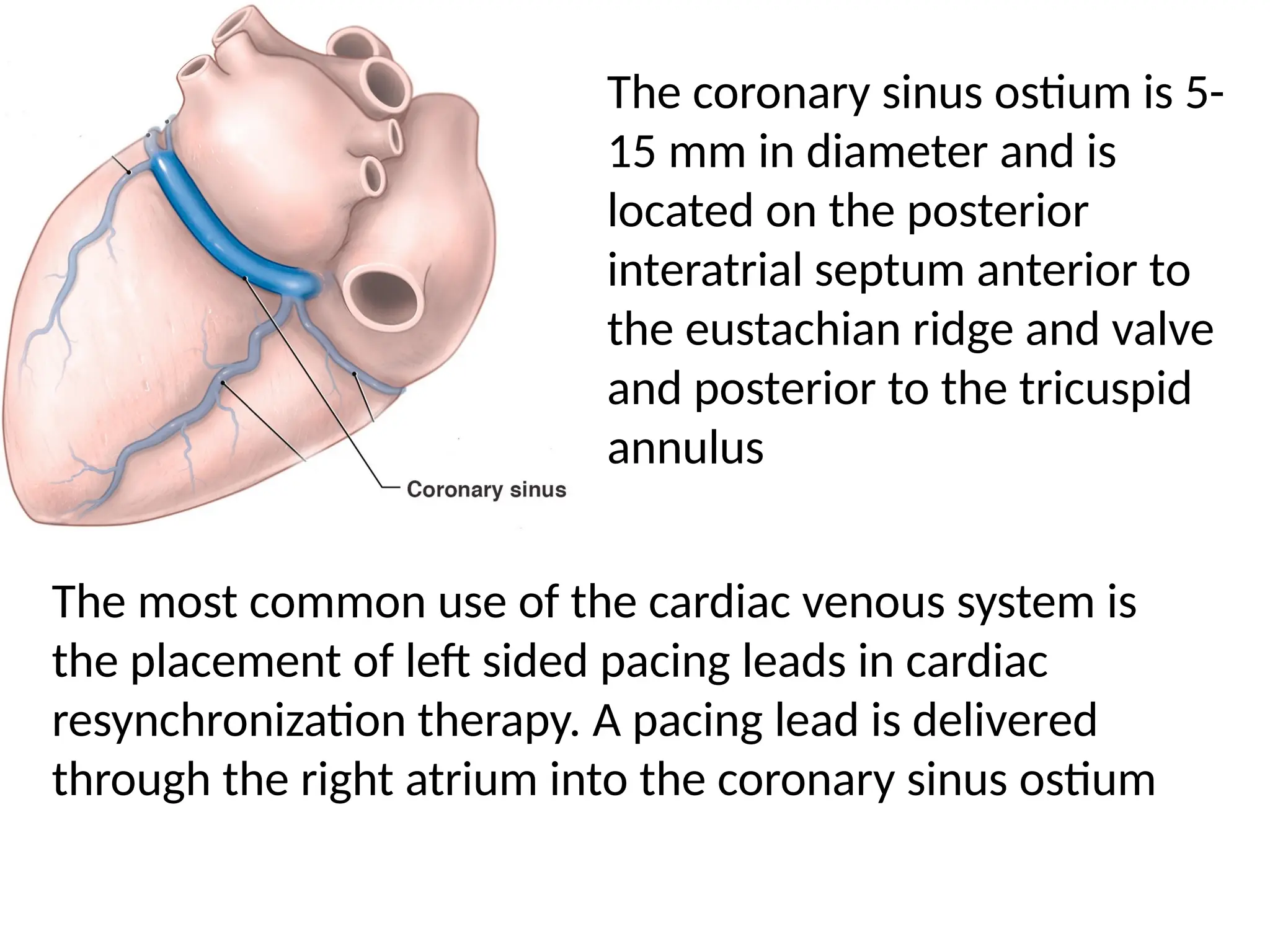 Journal - Anatomy of the coronary sinus.pptx