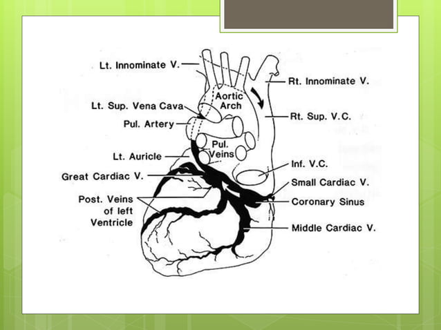 Coronary sinus anatomy | PPTX