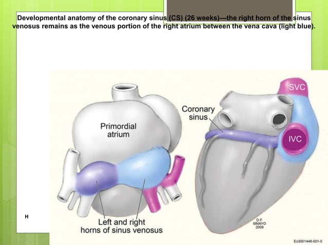Coronary sinus anatomy | PPTX
