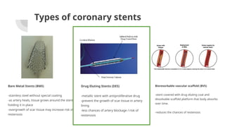 CORONARY STENT in ct cardiac presentation .pptx