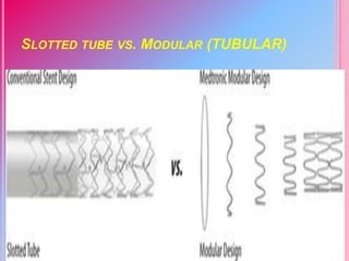 Different Coronary stent design PPT | PPTX