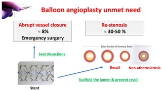 Coronary stents: A comprehensive overview of coronary stents | PDF