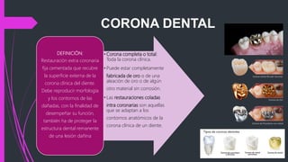 Coronas coladas metalicas de oro | PPTX