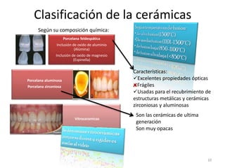coronasmetal-ceramica anteriore.s 2.pptx