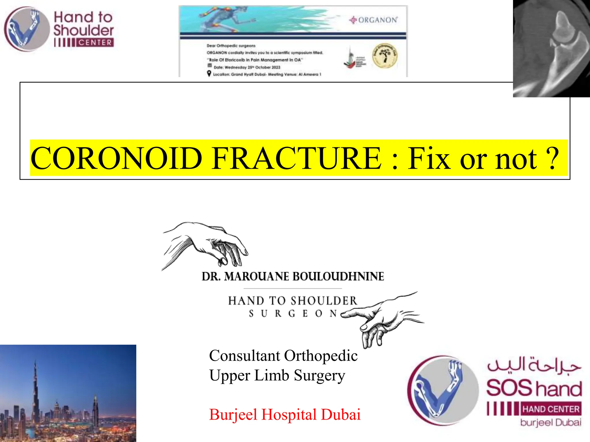 Coronoid fracture: Fix or Not?.pptx