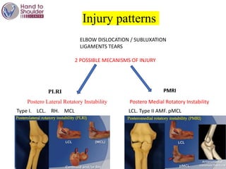 Coronoid fracture: Fix or Not?.pptx