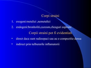 Corpi straini | PPT