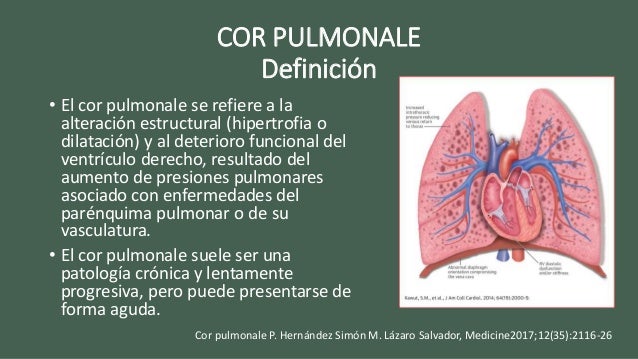 Cor pulmonale