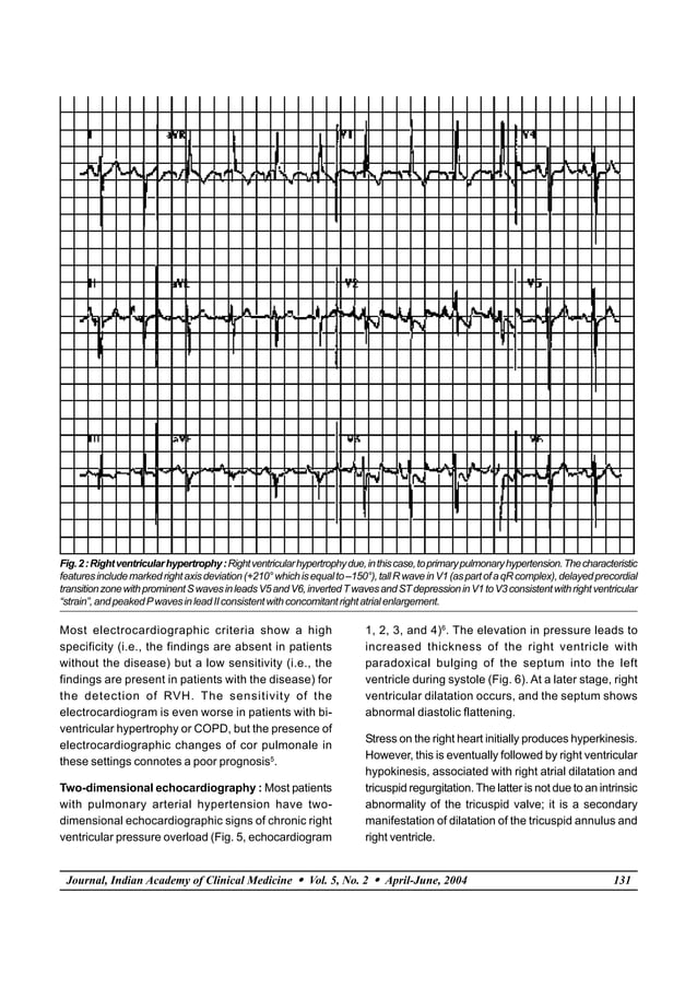 Cor pulmonale | PDF | Heart and Cardiovascular Diseases | Diseases and ...