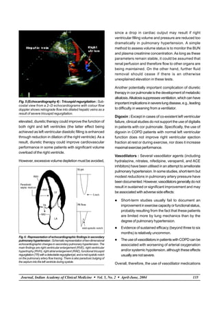 Cor pulmonale | PDF