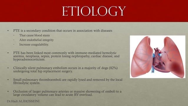 Cor pulmonale | PPT