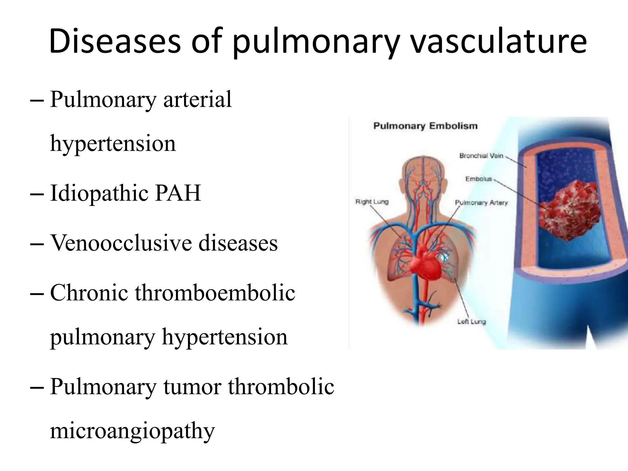 Corpulmonale | PPTX