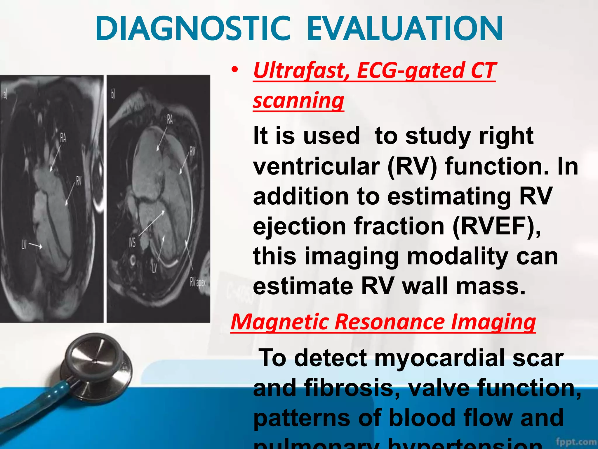 Corpulmonale | PPTX