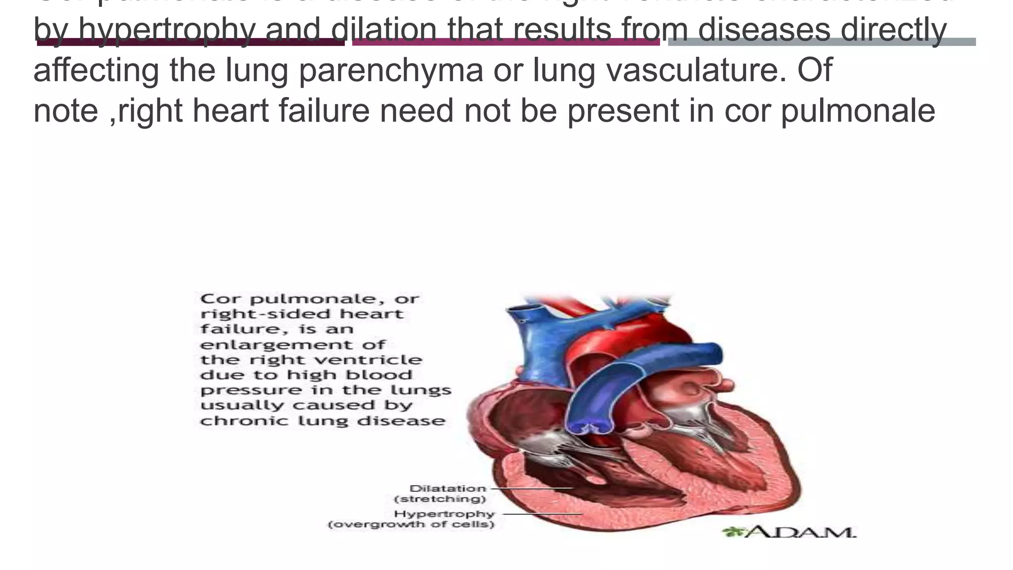 Cor pulmonale.pptx