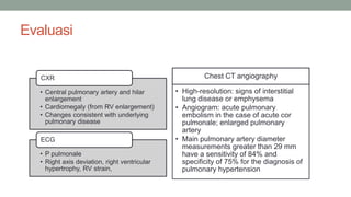 COR PULMONALE CHRONIC elsy.pptx