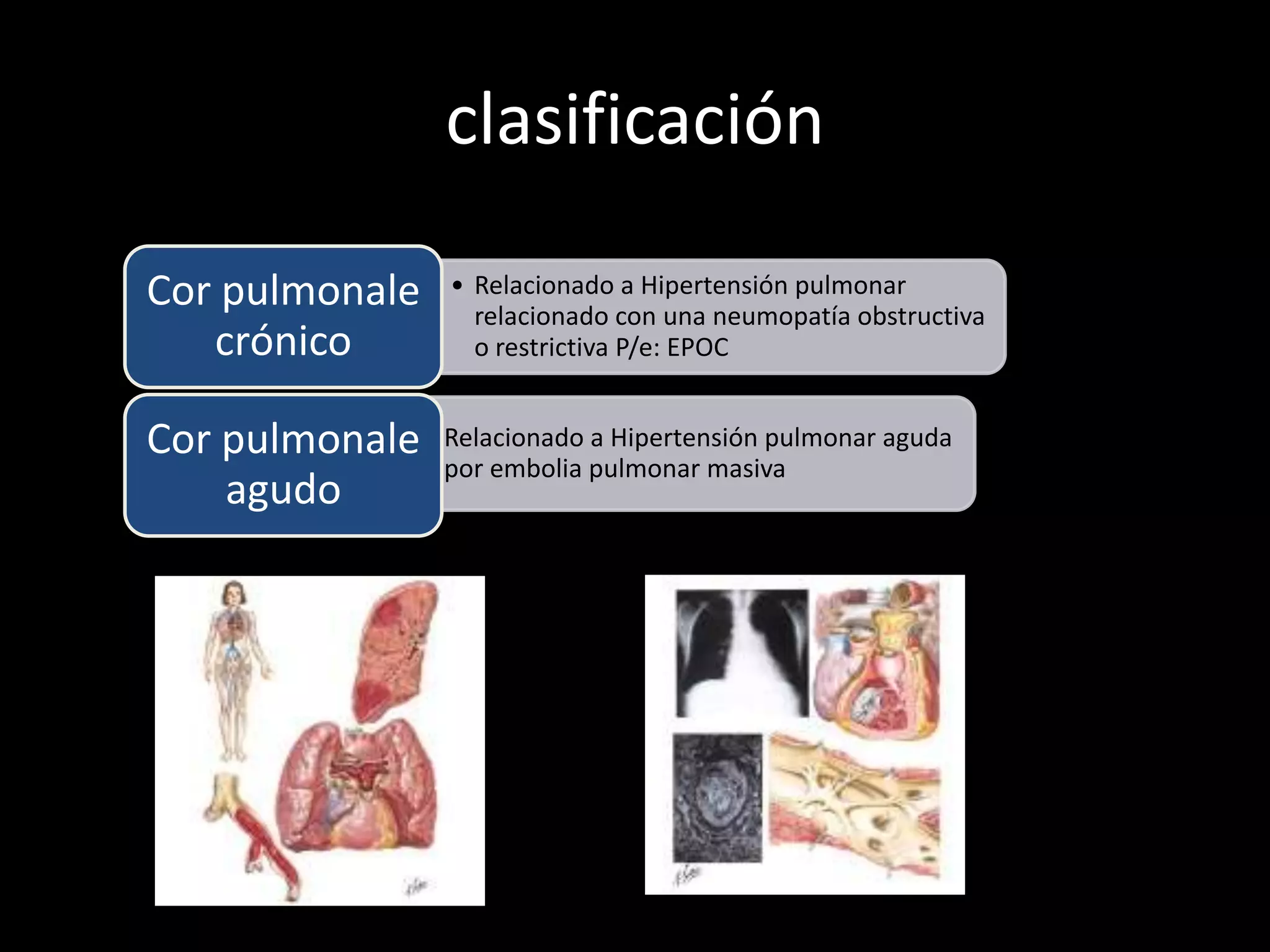 Cor pulmonale | PPT