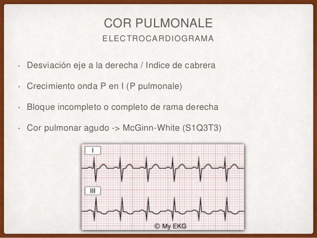 Cor pulmonare