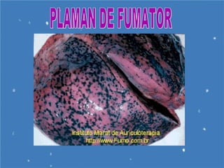Corpul omenesc organe interne | PPT