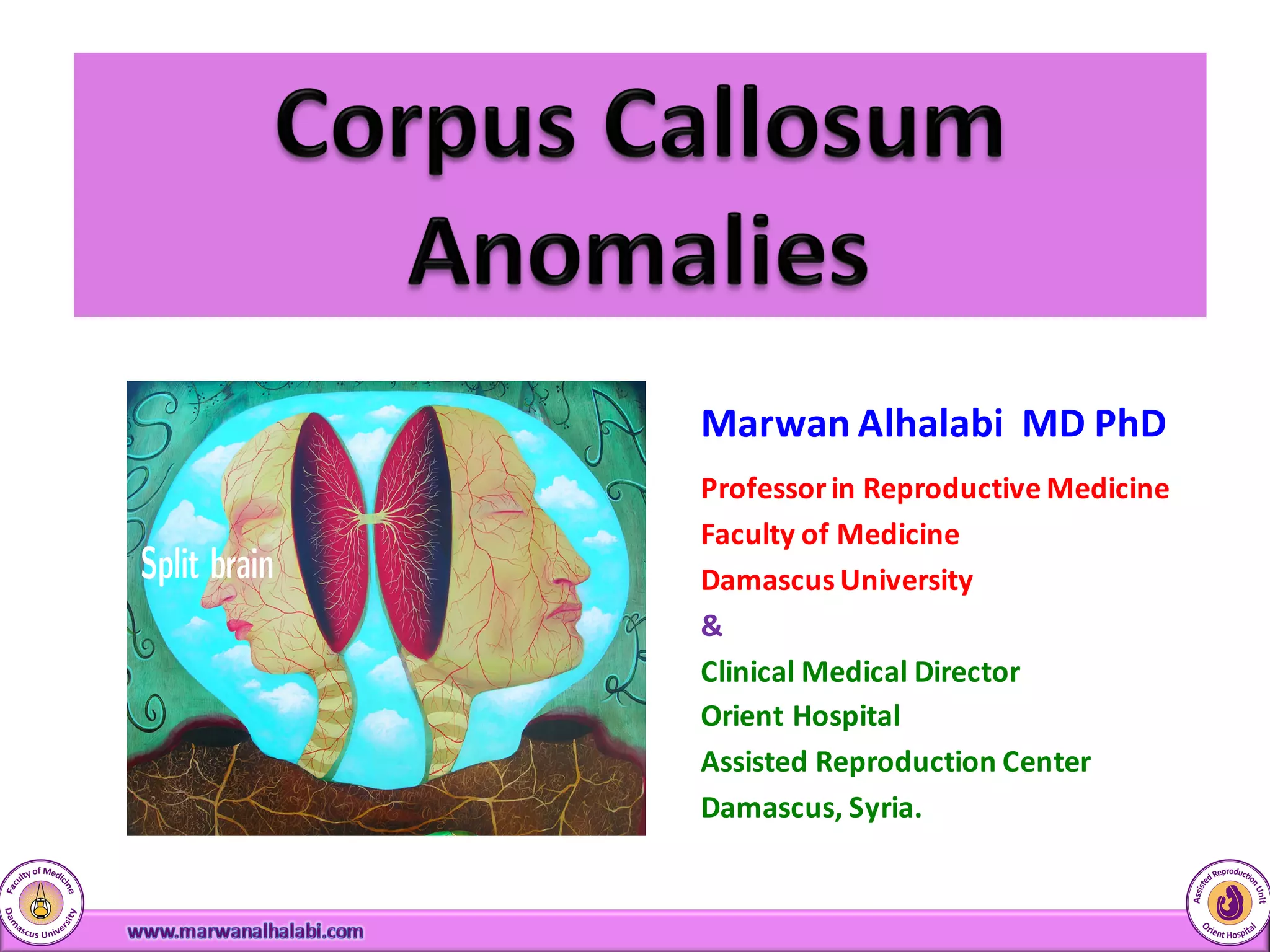 Corpus Callosum Anomalies | PDF