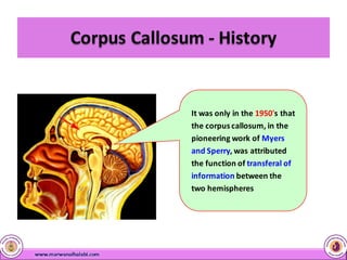 Corpus Callosum Anomalies | PDF