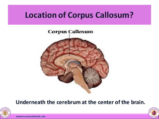 Corpus Callosum Location