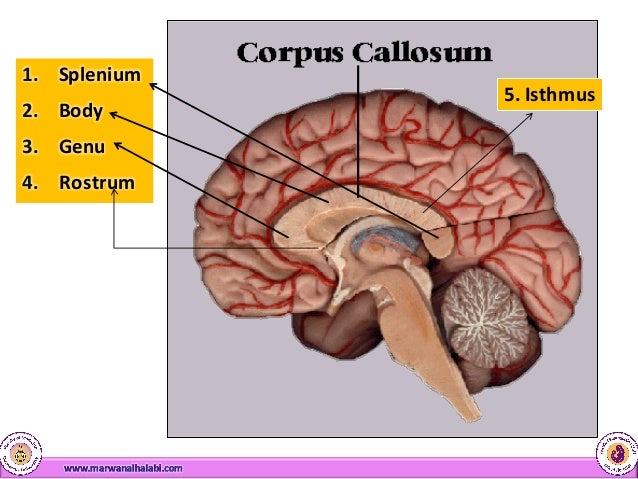 Corpus Callosum Anomalies