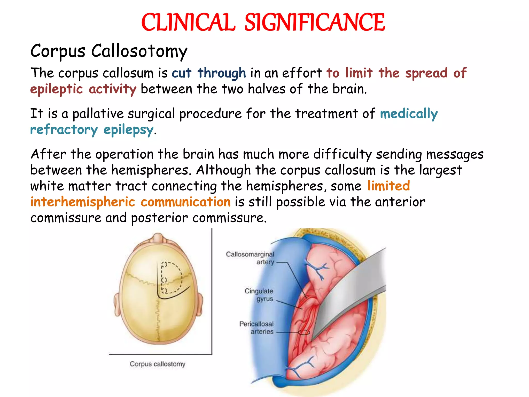 Corpus callosum | PPTX