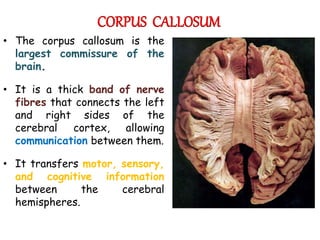 Corpus Callosum Parts