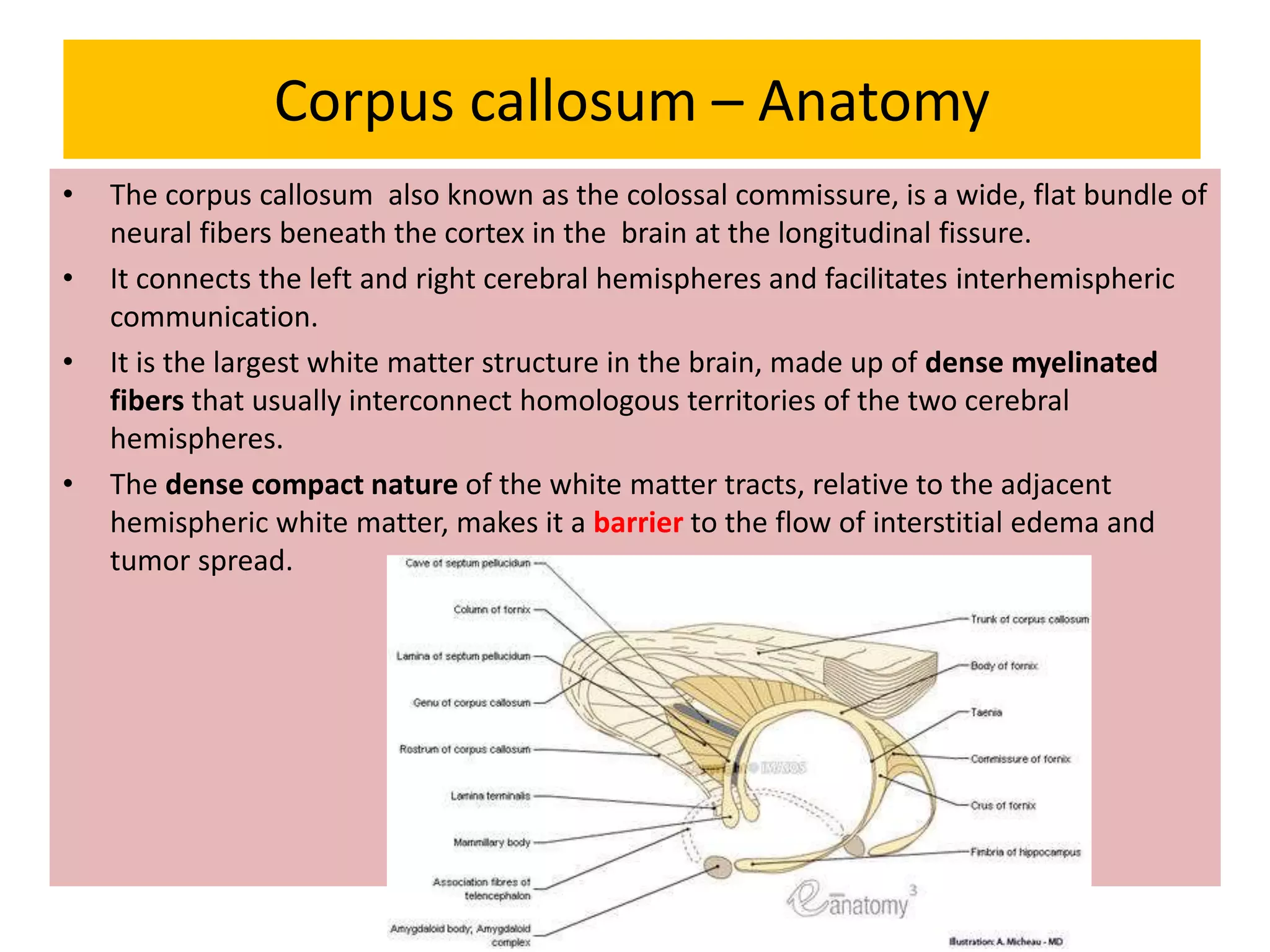 Corpus callosum with disconnection syndromes | PPTX
